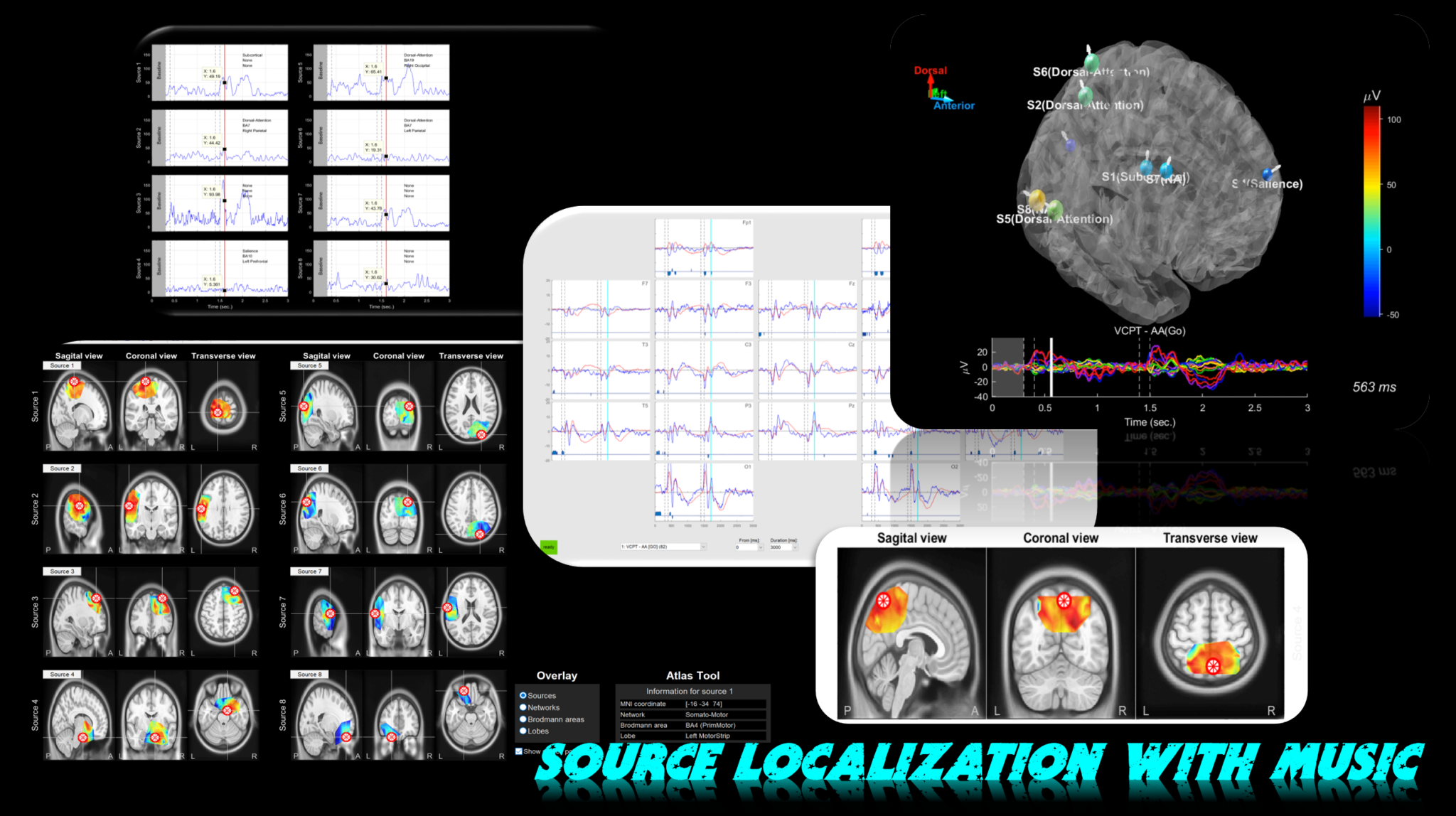 What is developed where in the brain – GTSG
